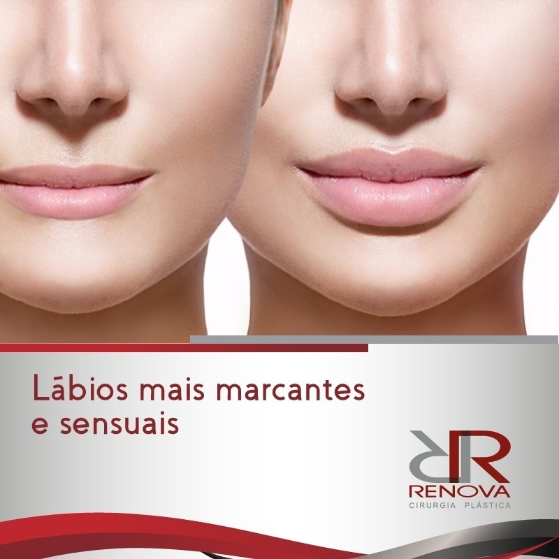 Lábios mais marcantes e sensuais - Clínica Renova