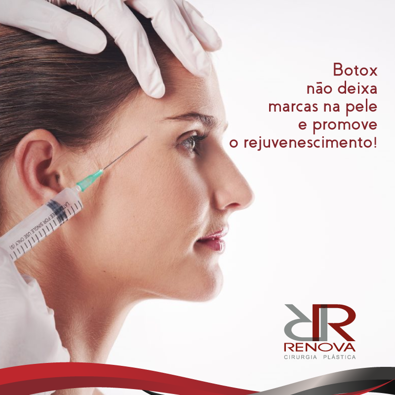 Botox não deixa marcas na pele e promove o Rejuvenescimento! - Clínica ...