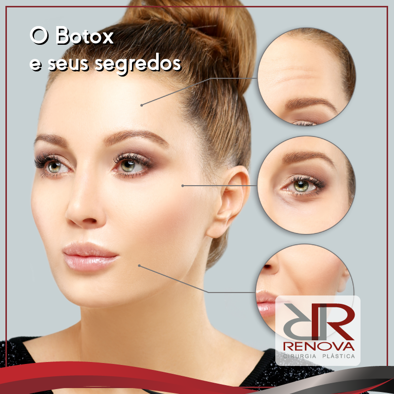 O Botox e seus segredos - Clínica Renova