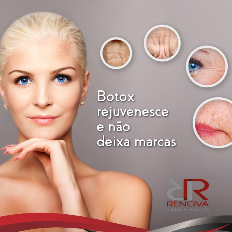 Botox rejuvenesce e não deixa marcas - Clínica Renova